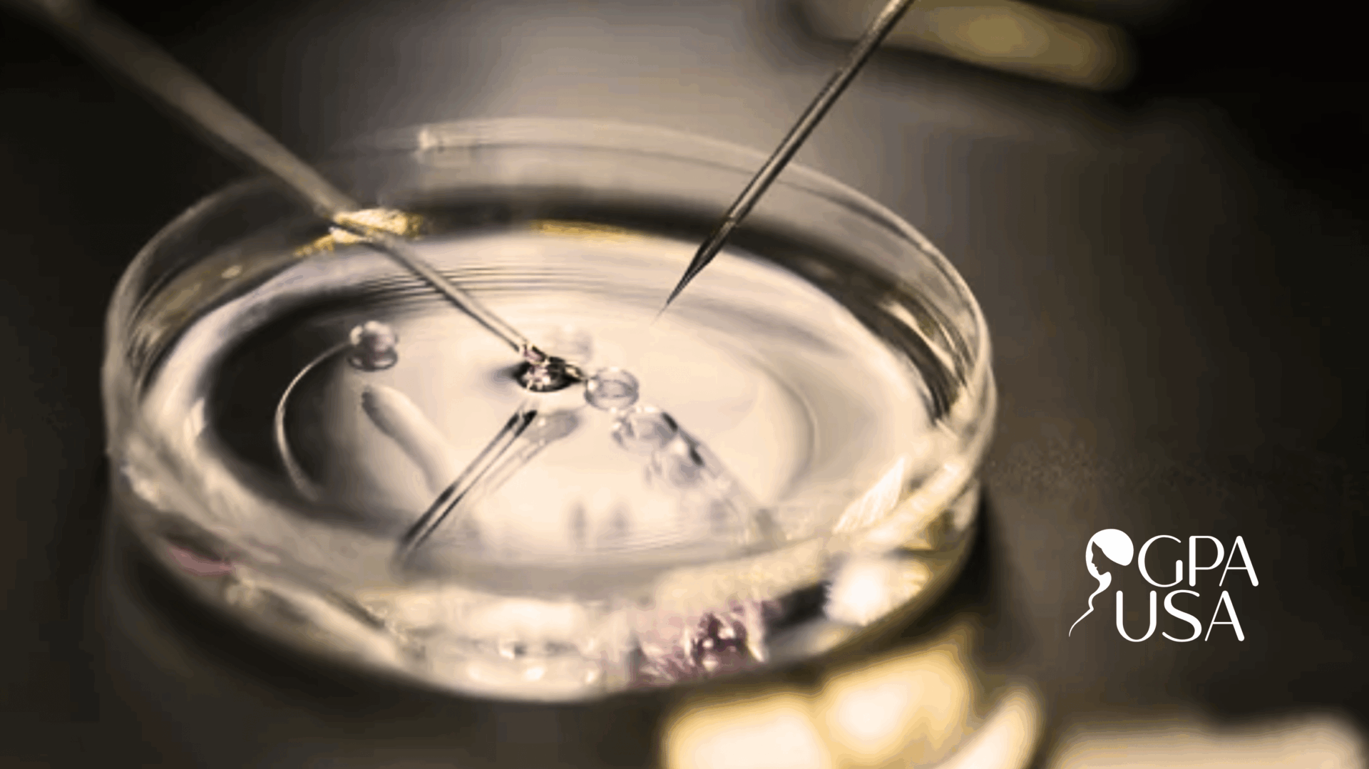 Le processus de FIV - GPAUSA